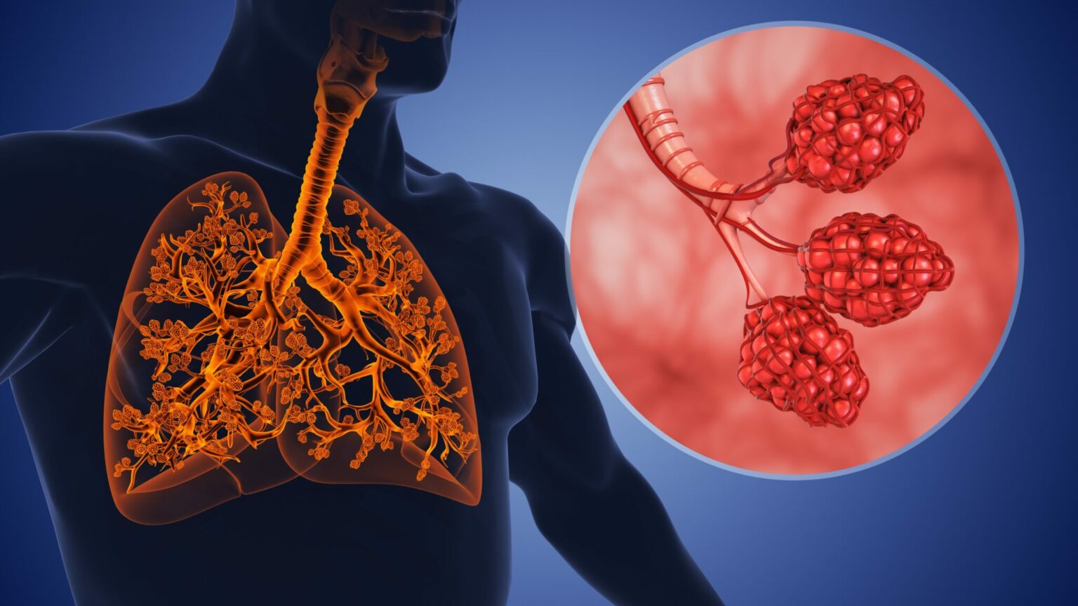 O que é a asma: relação com a apneia - Terapia CPAP Portugal